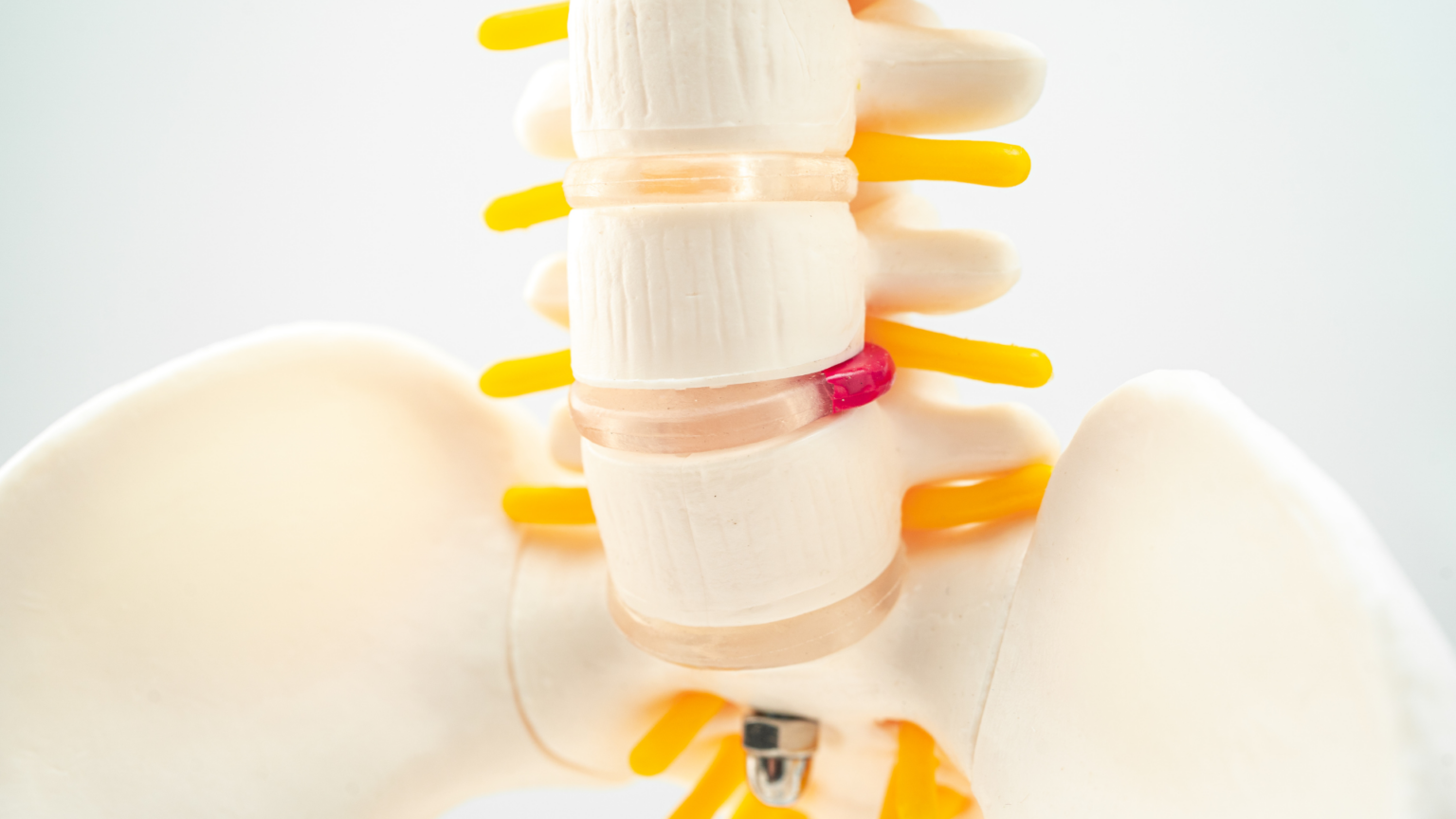 Exercises To Avoid If You Have A Lumbar Disc Bulge At L4 L5 or S1