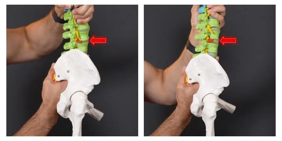 Lumbar Spinal Stenosis: The Safest Core Exercise For Recovery